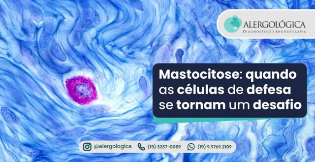 Mastocitose: quando as células de defesa se tornam um desafio → ...